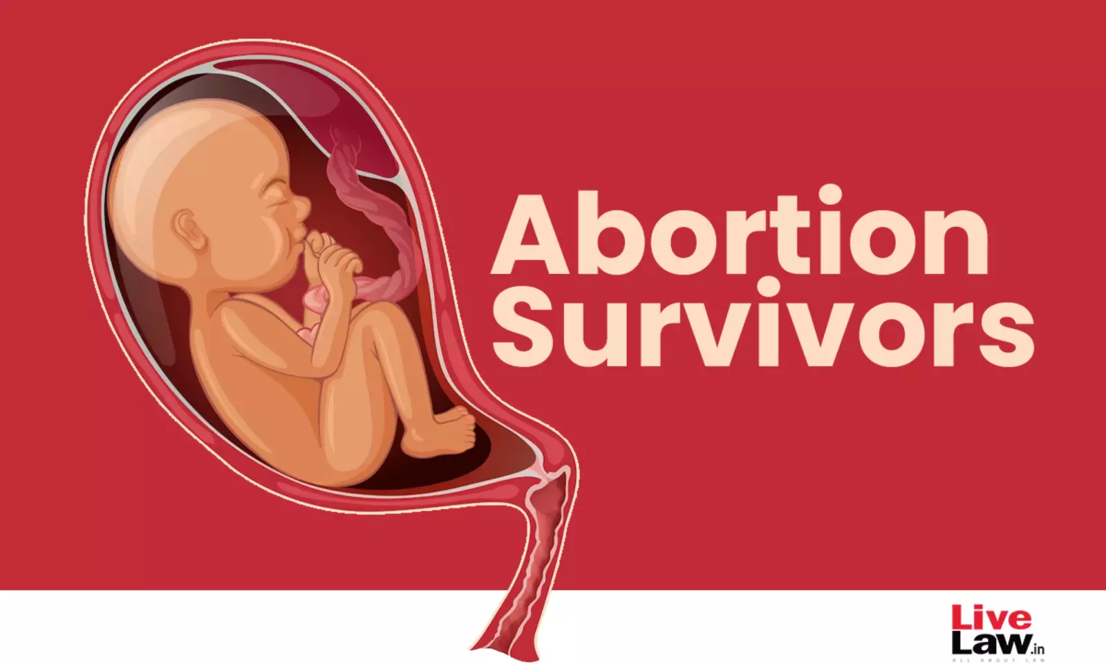 Aborted Babies Who Survive